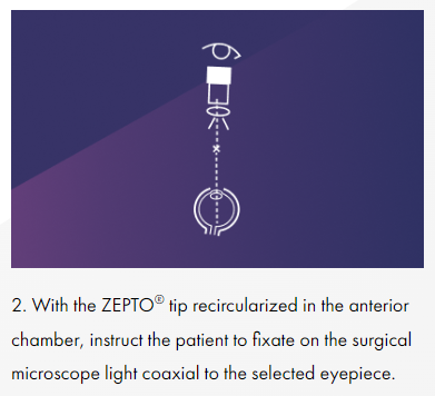 Introducing Zepto®, A New System Added For Cataract Surgery - Naples ...