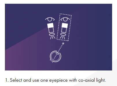 Introducing Zepto®, A New System Added For Cataract Surgery - Naples ...